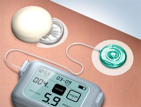 Lohmann GmbH & Co. KG | Medical Device Supplier Directory | Qmed+ ...